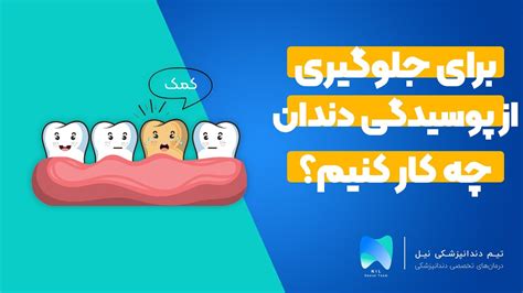 برای نداشتن دندان پوسیده چی کار کنیم؟ Youtube