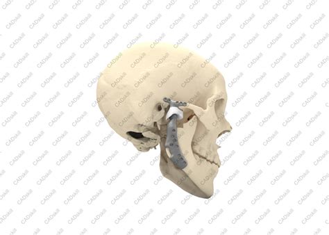 Tmj Tjr Parametro Surgeon Concept Cadskills