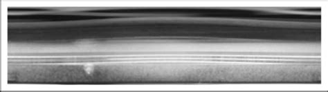 Smoothing Result After Median Filter Download Scientific Diagram