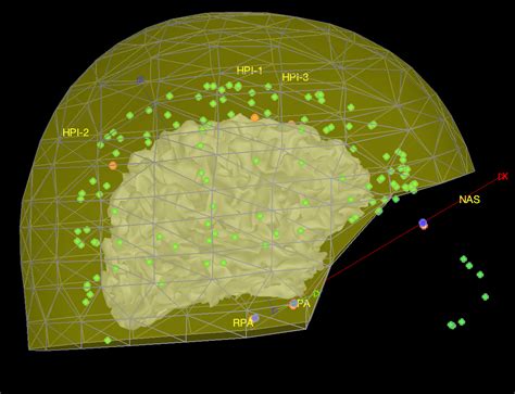 Forward Model From Brainstorm To Mne · Issue 7871 · Mne Toolsmne Python · Github
