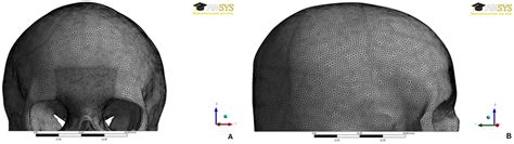 The Finite Element Skull Model A Fe Model Meshed With Small