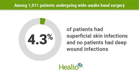 Wide Awake Hand Surgery May Be Safe Yield High Patient Satisfaction
