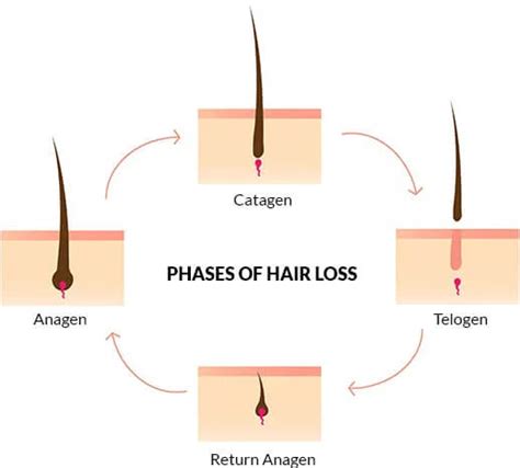 All About Hair Loss Veta Care