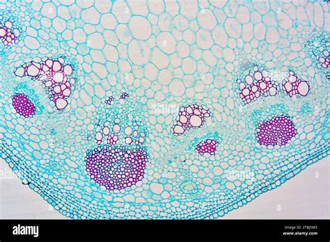 Eudicot Stem Helianthus Annuus Showing Epidermis Collenchyma Cortex