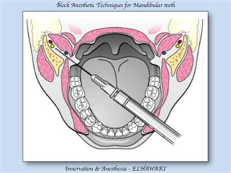 Mandibular Teeth Anesthetic Block Techniques