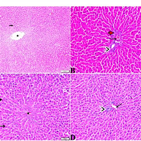 Figure Photomicrographs Of Hepatic Tissue Sections Stained With Hande Download Scientific Diagram