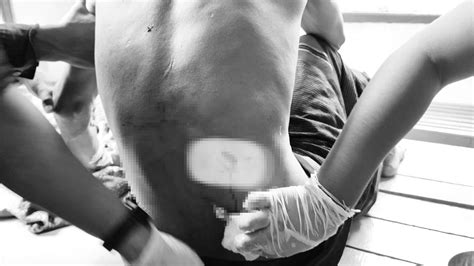 ဖြူးမှာ လက်နက်ကြီးကြောင့် ကလေးအပါအဝင် အရပ်သားနှစ်ဦး ဒဏ်ရာရ — မြန်မာဌာန