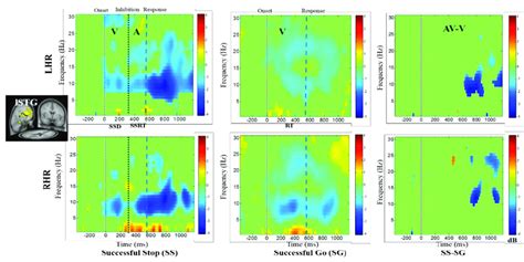 The Ersp Plots Showing The Post Stimuli Modulations In Right Superior Download Scientific