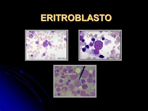 GLOBULOS ROJOS ERITROPOYESIS ERITROPOYESIS MEMBRANA ERITROCITARIA MEMBRANA ERITROCITARIA