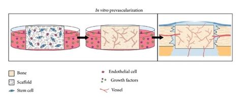 Vascularization Approaches For Bone Tissue Engineering A In Vitro Download Scientific