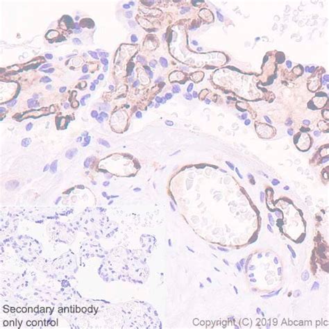 Antigen Retrieval 100x Tris Edta Buffer Ph 90 125 250 Ml Ab93684