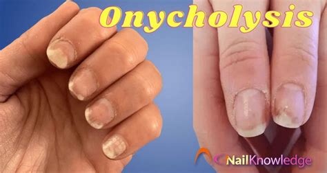 Pin On Nails