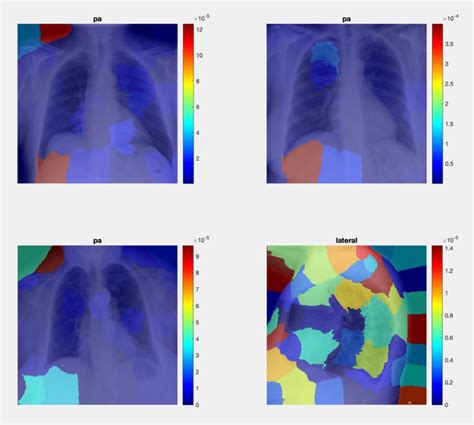 explainable ai for medical images