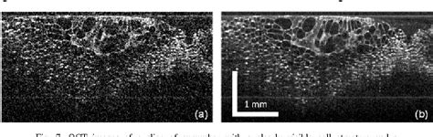 Figure 7 From Fourier Domain Mode Locked Swept Source At 1050 Nm Based On A Tapered Amplifier