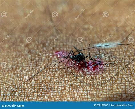 El Peligro De La Malaria Por Picaduras De Mosquito Mosquitos En La