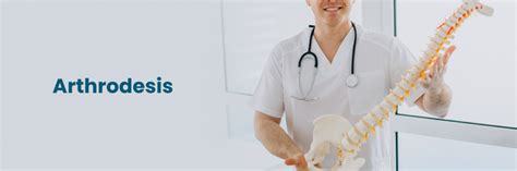 Arthrodesis Types Indications And Recovery Process