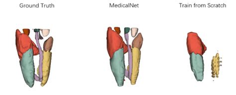 腾讯优图开源业界首个3D医疗影像大数据预训练模型MedicalNet 腾讯云开发者社区 腾讯云
