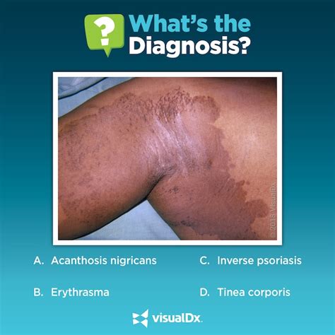 Is Deodorant Causing This Mans Underarm Rash Lets Diagnose