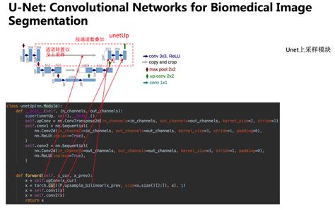 U Net Convolutional Networks For Biomedical Image Segmentation · Issue