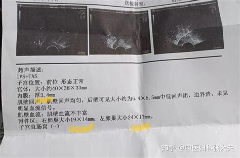 45岁3个月没来月经一查B超性激素绝经了接受不了 知乎