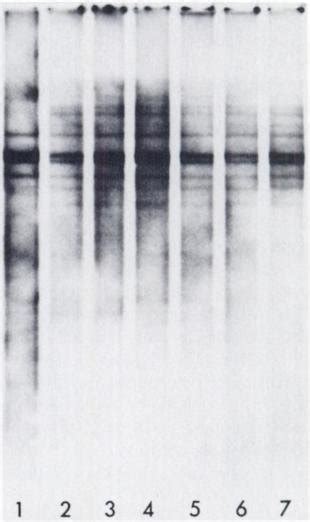 Ecori Restriction Patterns Of Mumtv Proviral Dna Comparing Individual Download Scientific
