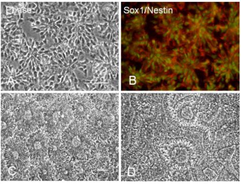 Human Esc Derived Neuroectodermal Precursors In Neural Open I