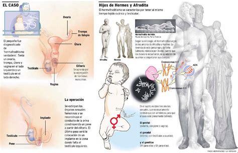 Hermafrodito El Paradójico Hijo De Hermes Y Afrodita ~ Greciaaplicada