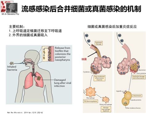 施毅：重症流感合并侵袭性肺曲霉菌感染死亡率显著高于其它病原菌 医学界 助力医生临床决策和职业成长