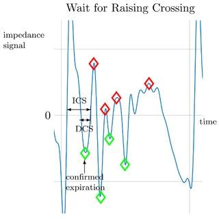Illustration Of The Zero Crossing Algorithm With Identical Crossing Download Scientific Diagram