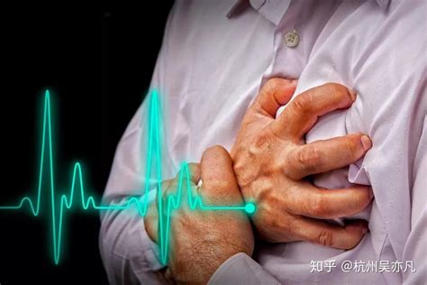 突然一阵心悸是心脏病吗医生先排除这两种情况 知乎