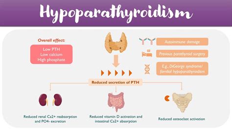 Hypoparathyroidism Explained Parathyroid Hormone Youtube