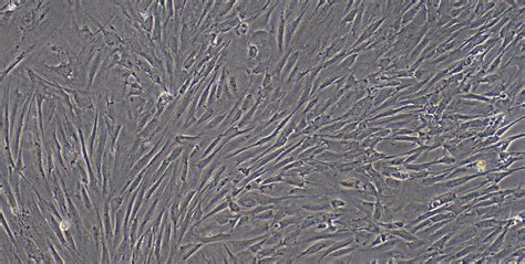 Csi088mu01 Primary Mouse Neonatal Dermal Fibroblasts Ndf Mus Musculus Mouse Uscn Wuhan