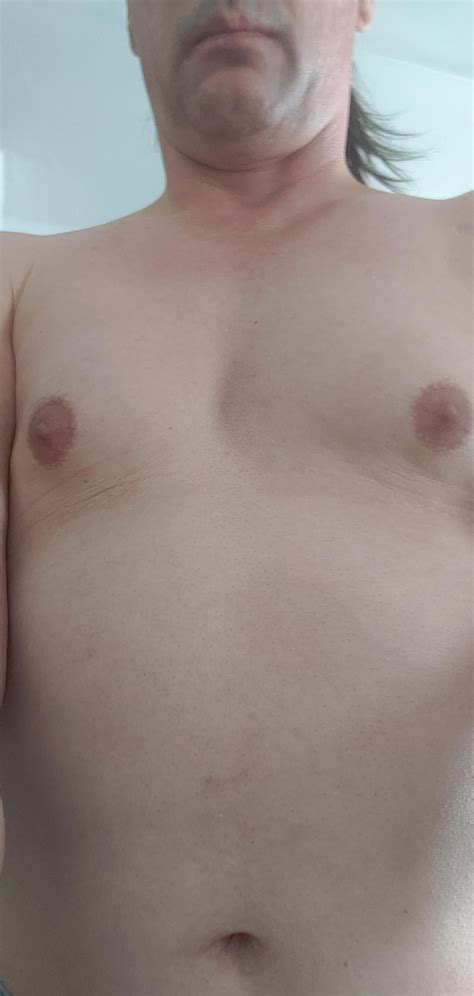 Estraidol 1mgday Transdermal Rtransbreasttimelines