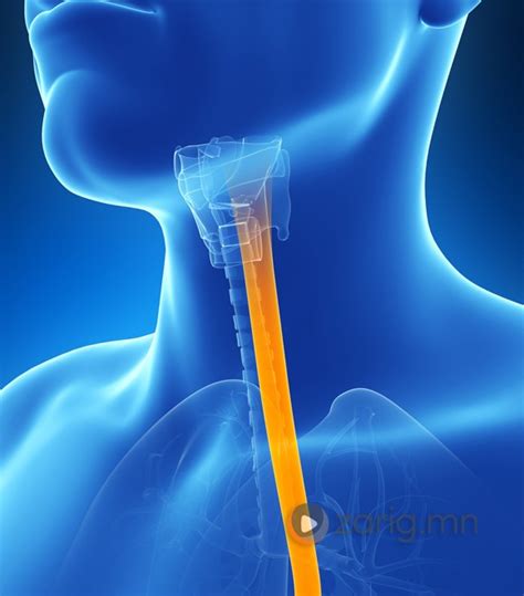 Улаан хоолойн хорт хавдрын тусламж үйлчилгээг ЭМД ын сангаас бүрэн хариуцна