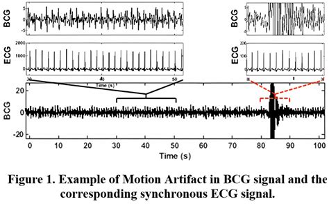 Machine Learning Approach For Motion Artifact Detection In Ballistocardiogram Signals Request Pdf
