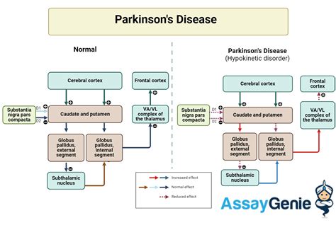 Understanding Parkinsons Disease Insights And Innovations Assay Genie