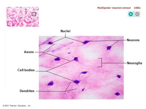 Microscope Nervous Tissue Labeled Micropedia