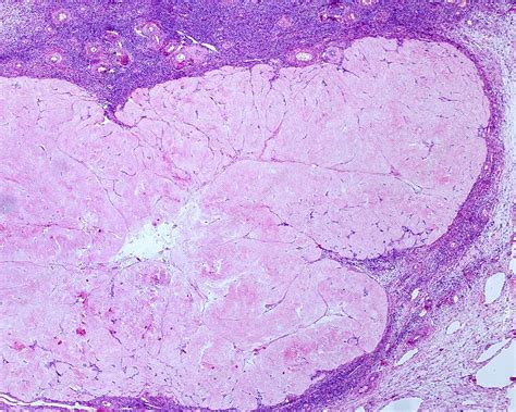 Corpus Albicans Light Micrograph Stock Image C0460570 Science