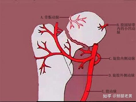 被称为人生中最后一次骨折的 股骨颈骨折为什么它这么恐怖 知乎