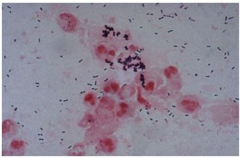 Laboratory Diagnosis For Streptococci Flashcards Quizlet