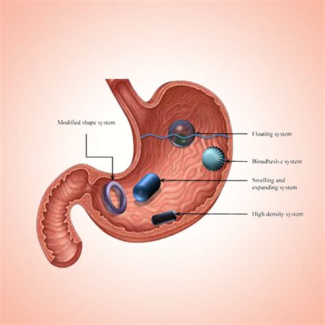 A Blog On Floating Drug Delivery System Iimt University Official Blog Explore More