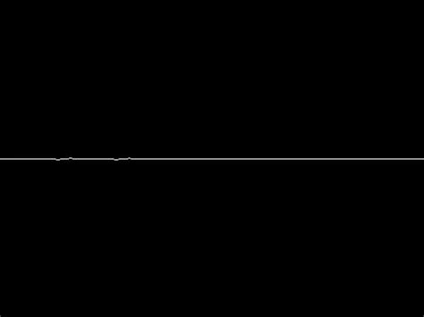 Two Particles Are Performing SHM In Same Phase It Means That Filo