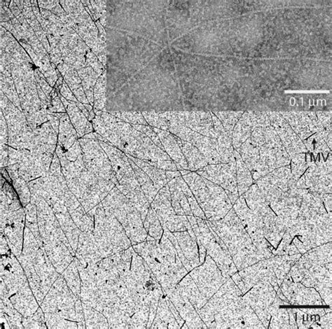 Microfilaments Electron Microscopy