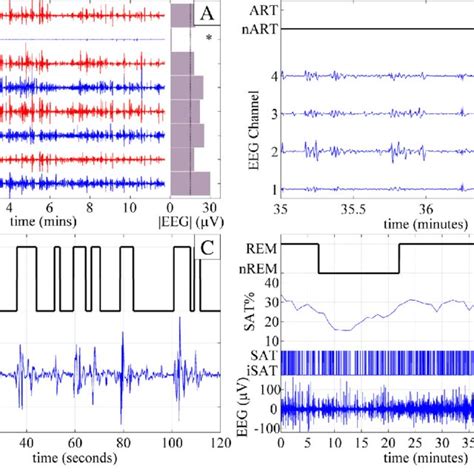 Example Epochs Of Preterm Eeg And A Model Of Eeg Segmentation A A