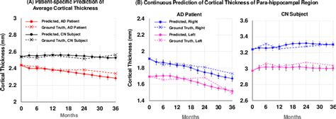Figure 1 From Conditional Score Based Diffusion Model For Cortical Thickness Trajectory