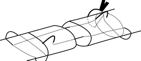 The Modified Side Locking Loop Technique Suggested By The Author The