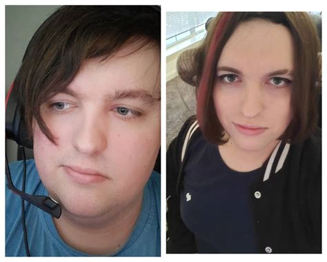 Face Gains 120 Pounds Lost 15 Months Hrt Scrolller