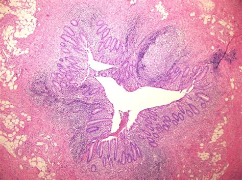 Normal Shaped Appendix H E 40 Download Scientific Diagram