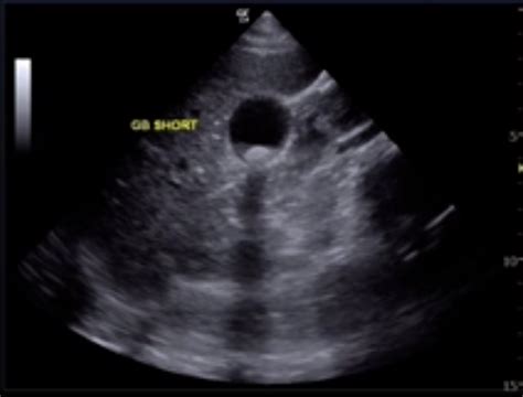 Ultrasound Leadership Academy Ruq Ultrasound — Em Curious