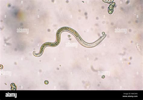 Toxocara Canis Egg Morphological Observations Of Toxocara Canis